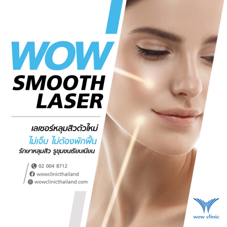 WOW SMOOTH LASER - WOW Clinic