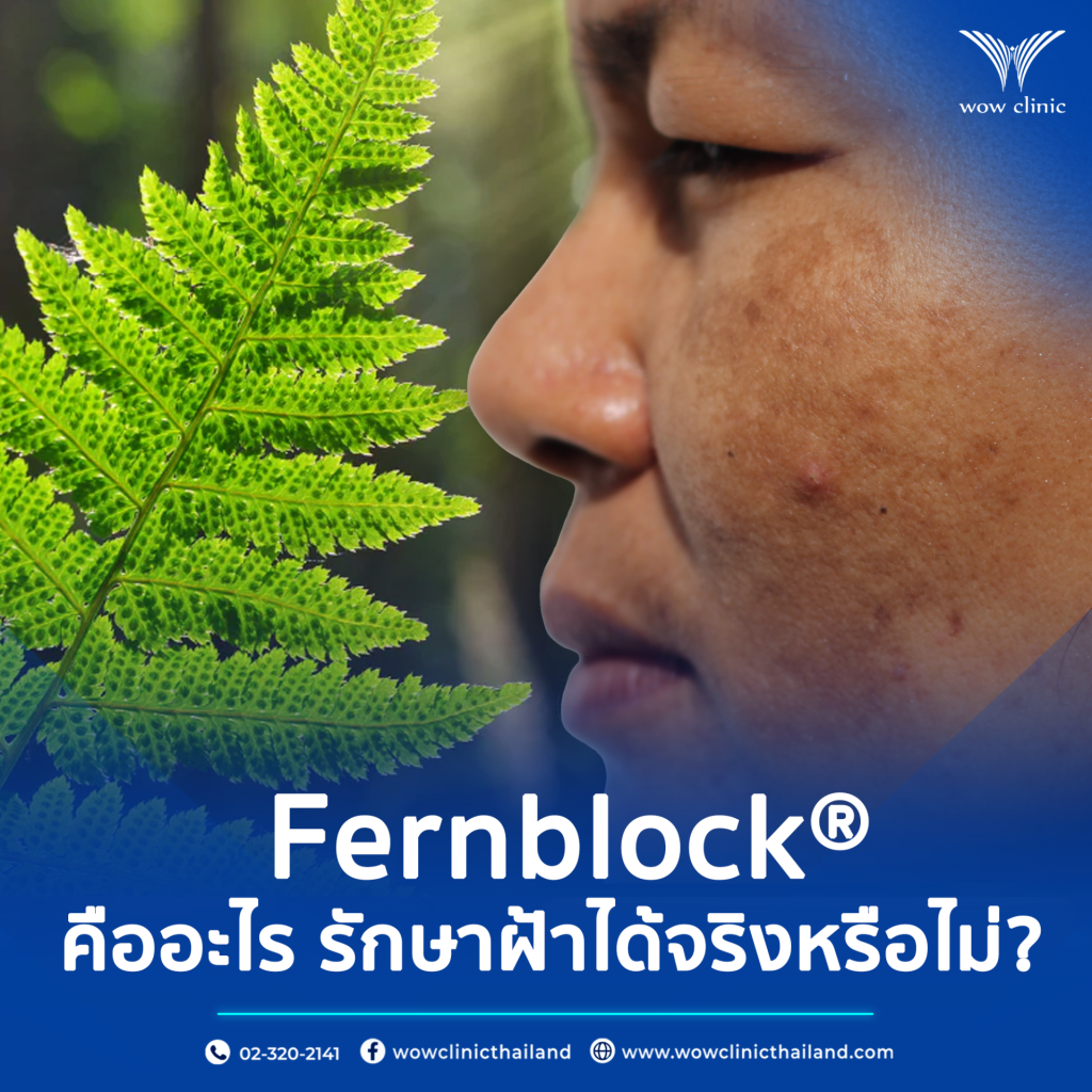 Fernblock® คืออะไร รักษาฝ้าได้จริงหรือไม่? - WOW Clinic